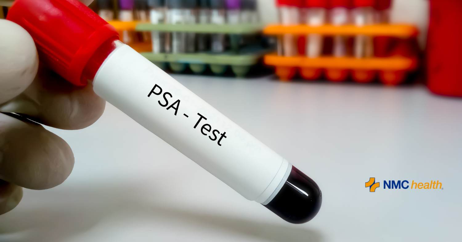 Understanding Common Prostate Issues: What You Should Know - NMC Health